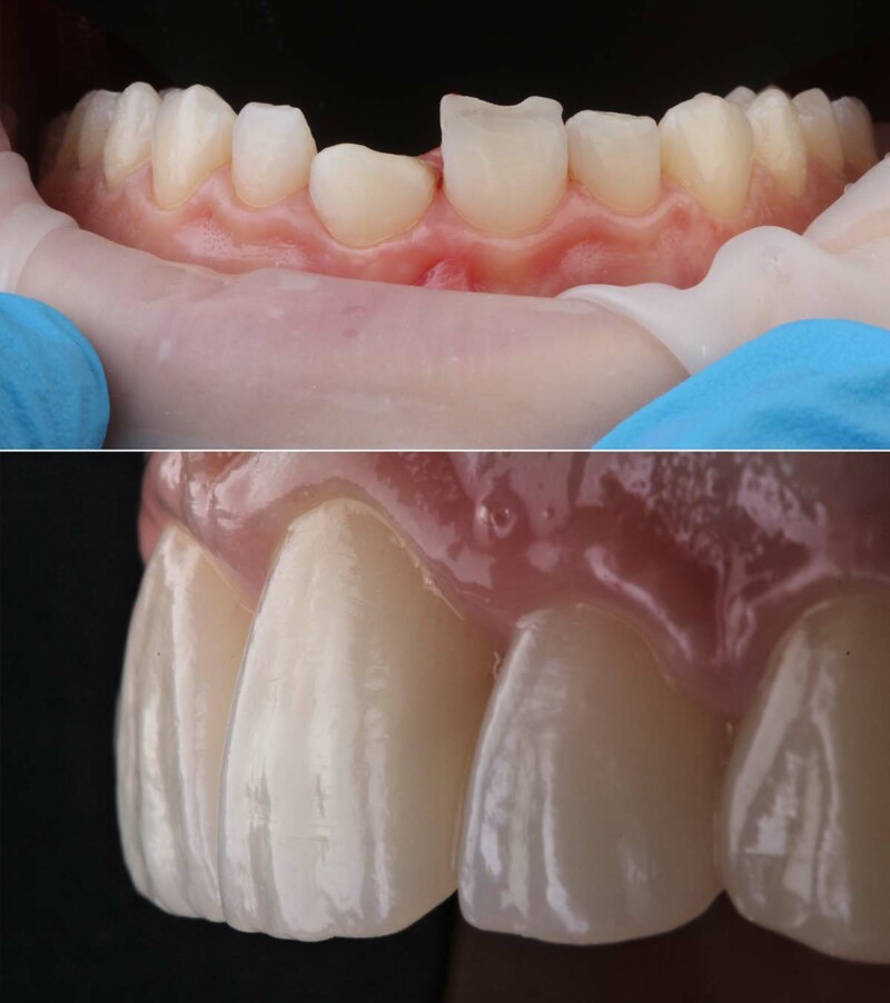Flowable Injection Anteriors Hands-On Course by David Geštakovski