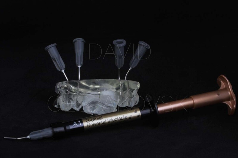 Flowable Injection Anteriors Hands-On Course by David Geštakovski